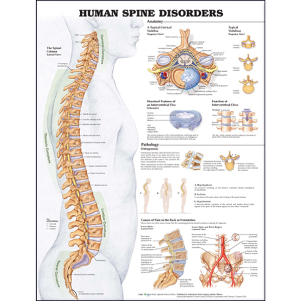 Human Spine Disorders Anatomical Chart - Whiteley Medical Supplies