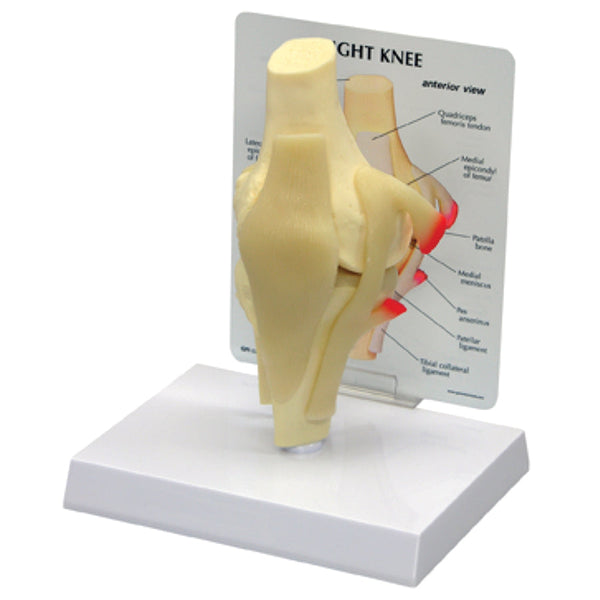 Basic Knee Model - Whiteley Medical Supplies